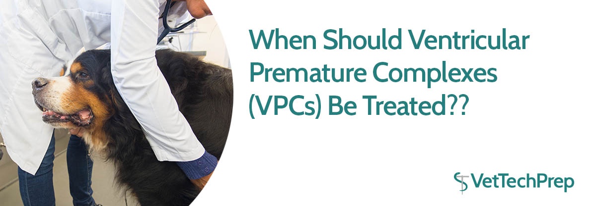 When Should Ventricular Premature Complexes (VPCs) Be Treated?